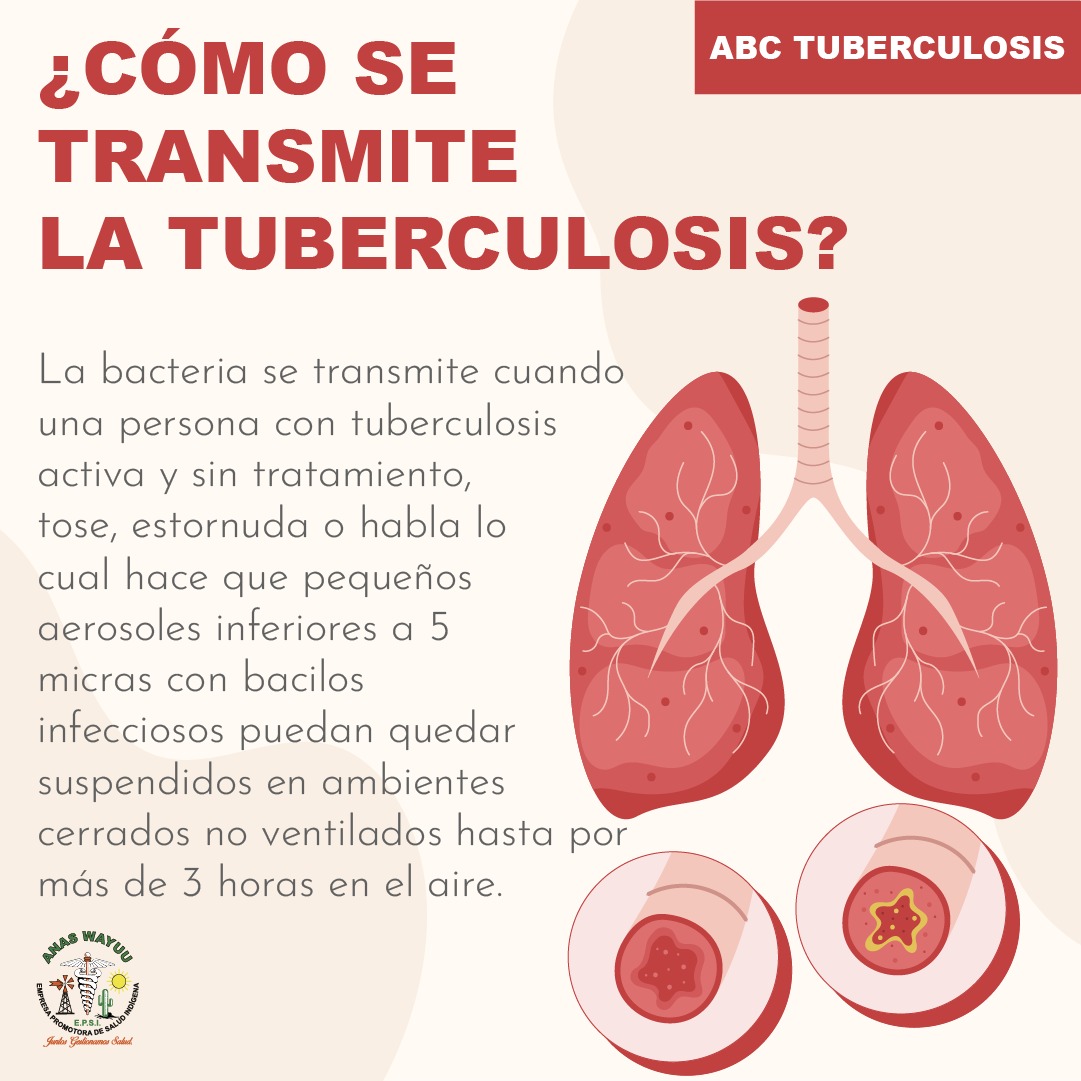 La tuberculosis puede ser mortal si no se trata adecuadamente – Anas Wayuu EPSI